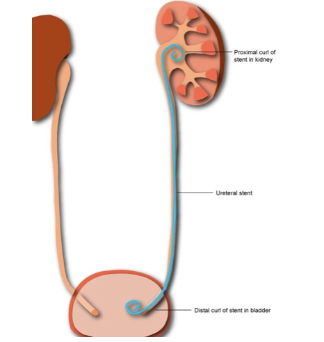 Orientações para pacientes em preparo para cirurgia endoscópica de ...